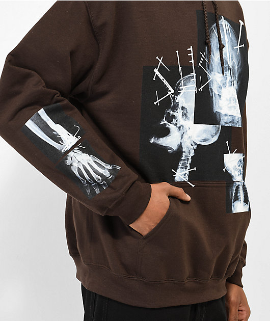 SUS BOY X-Ray Dark Brown Hoodie | Zumiez